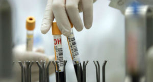 Monocitos ALTOS en Sangre: Síntomas, Causas y Tratamiento