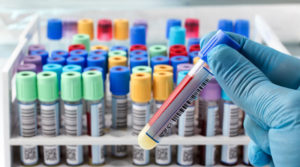 Monocitos ALTOS en Sangre: Síntomas, Causas y Tratamiento