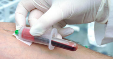 Monocitos ALTOS en Sangre: Síntomas, Causas y Tratamiento