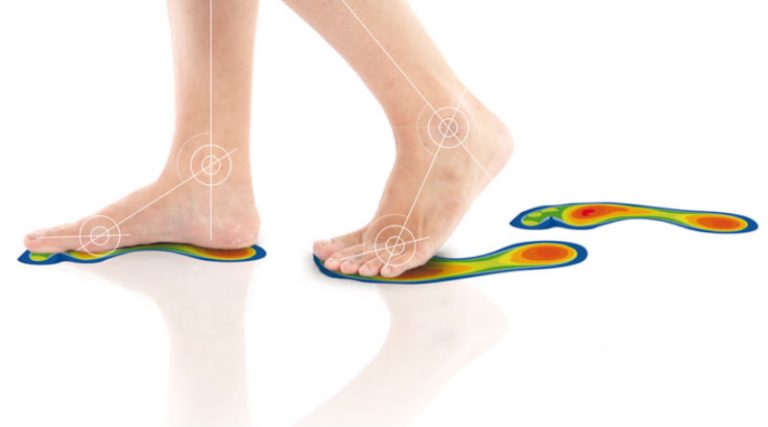 ¿En qué consiste el estudio de la pisada? - El Cosmonauta